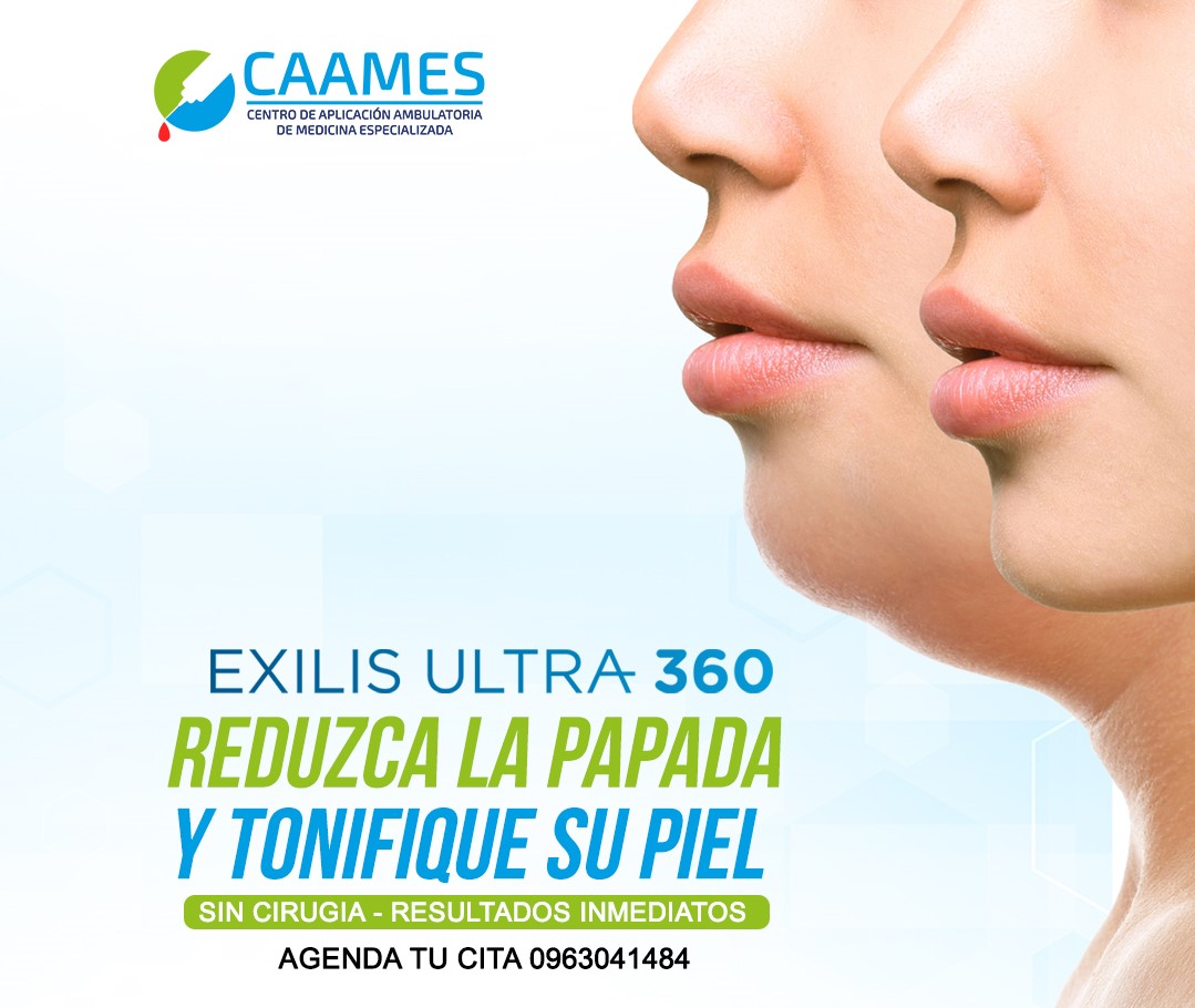 EXILIS ULTRA 360 | Promociones